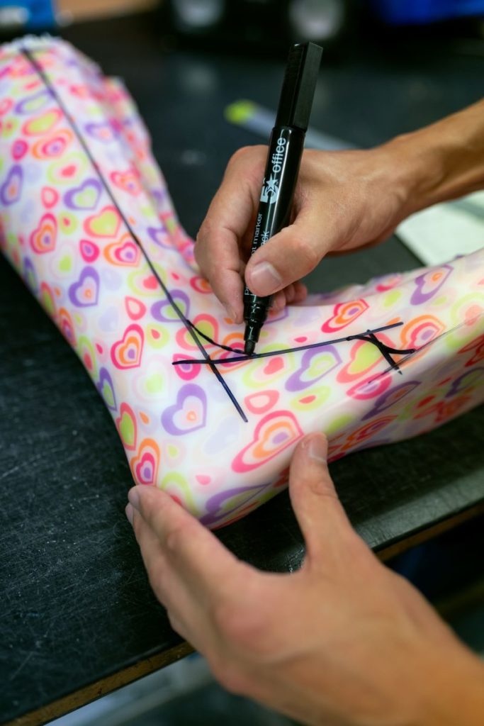 What is an Ankle Foot Orthosis (AFO) - Sunshine Coast NeuroRehab